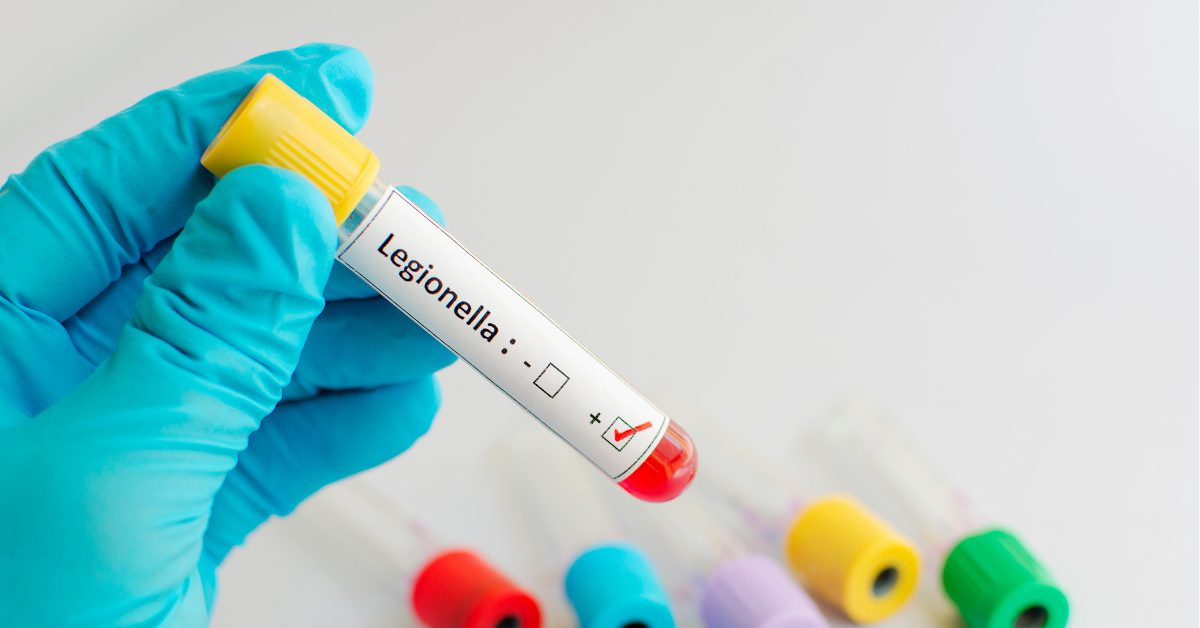 What Happens If Legionella Is Found in Your Building? - IWC Innovations